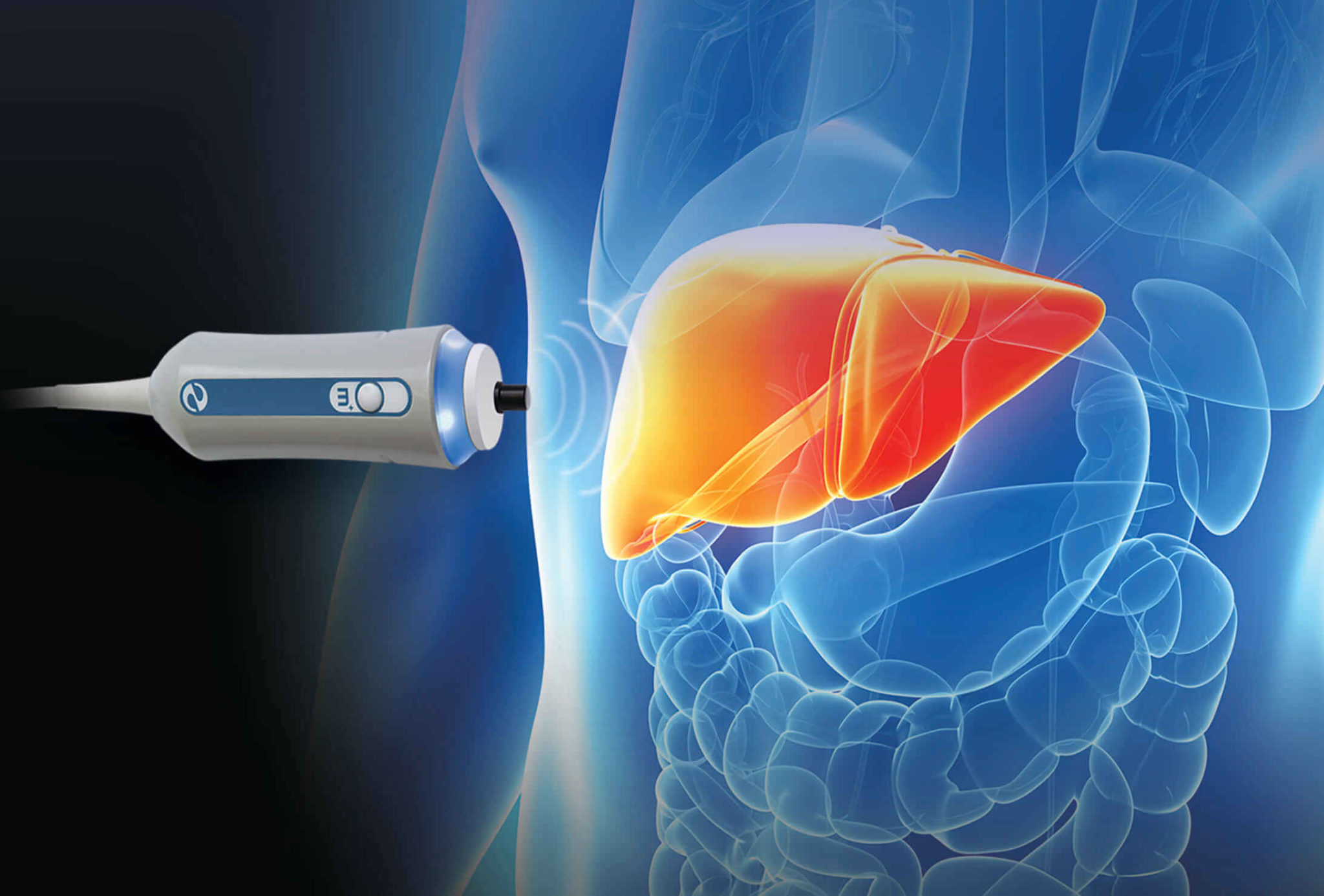 FibroScan® Liver Scan - Granite Peaks Gastroenterology of Utah